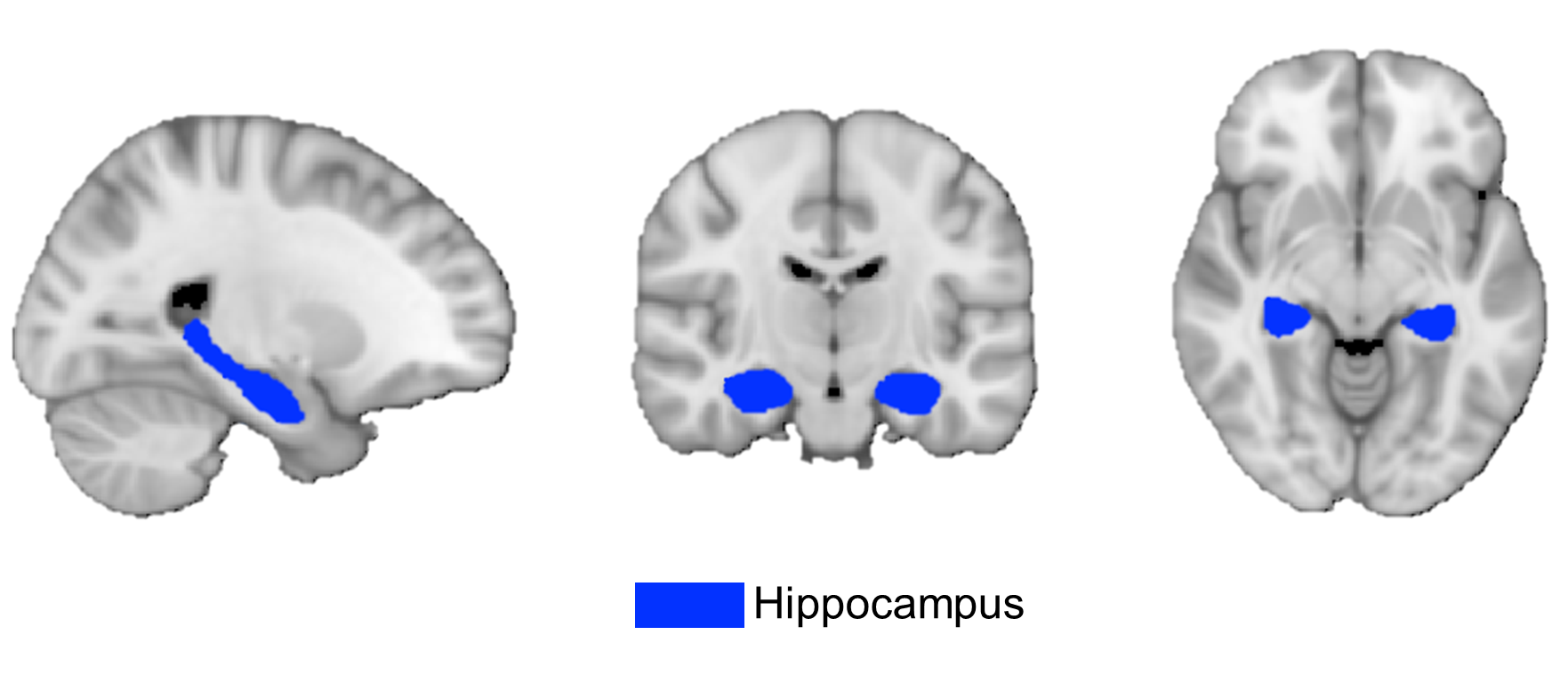 Sophie Allen: Replaying Autobiograhical Memories with HippoCamera – HSF ...